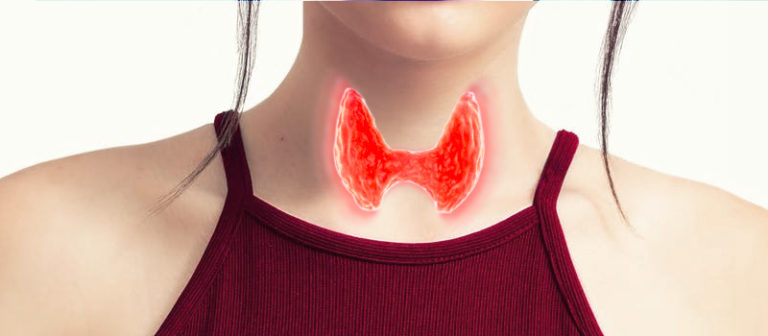 Tiroiditis-de-Hashimoto - Blog de tiroides | Dr. Óscar Vidal Blog de ... Tiroiditis-de-Hashimoto - Blog de tiroides | Dr. Óscar Vidal Blog de ...