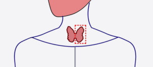 extirpar-medio-tiroides - Blog de tiroides | Dr. Óscar Vidal Blog de ...