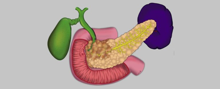 Què és el pàncrees, quina funció té i quines malalties pot desenvolupar ...
