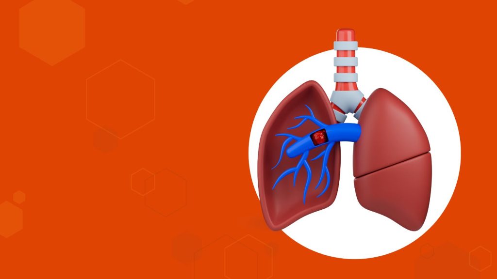 resección nódulo pulmonar archivos - Blog de Cirugía Torácica Blog de ...