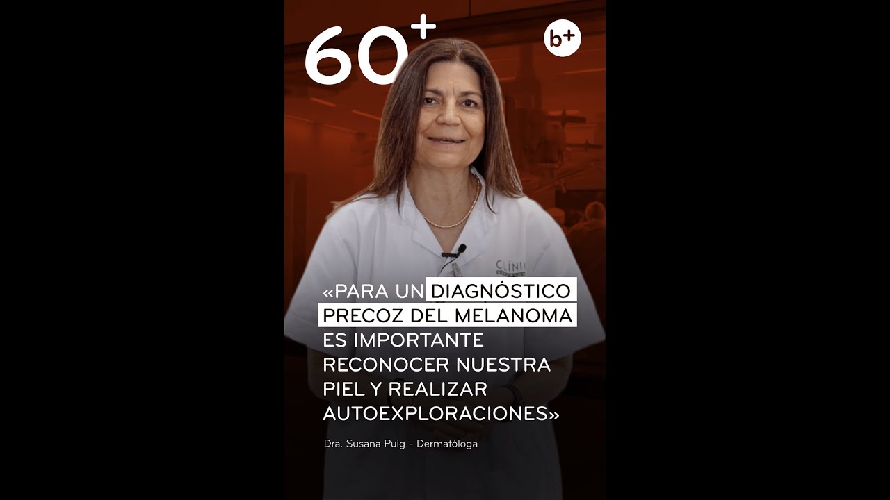 Melanoma diagnosis, self-examination and latest treatments Blog de ...