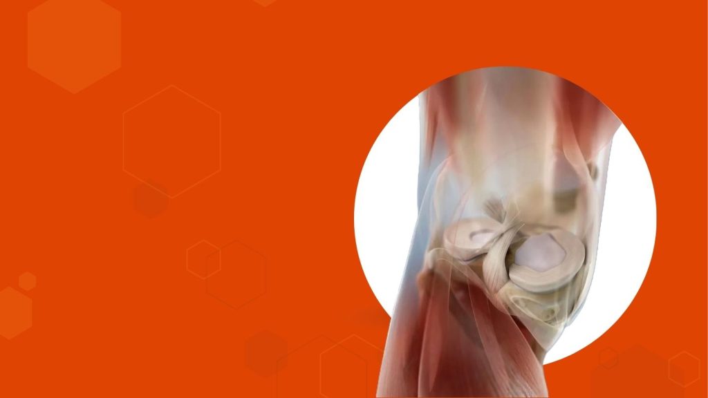 Tratamientos para el desgaste del cartílago de la rodilla Blog de ...