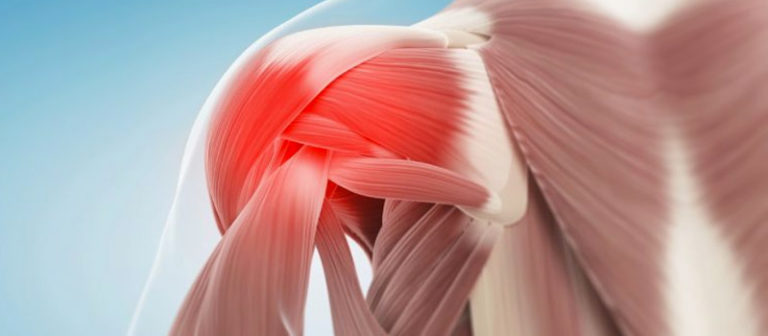 Manguito Rotador Archivos - Blog de Traumatología Deportiva Blog de ...