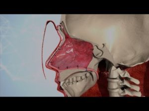 El-equipo-del-Dr.-Alobid-desarrolla-cirugía-que-permite-la ...